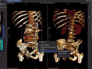 Weasis: Free DICOM viewer :: Weasis Documentation